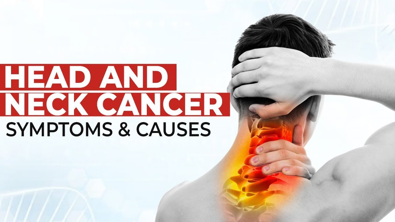 Head and Neck Cancer: Latest Advances in Treatment and Research ...
